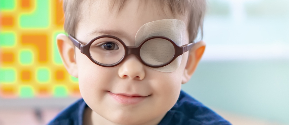 Lo strabismo: cause e sintomi - Santagostino Nembro